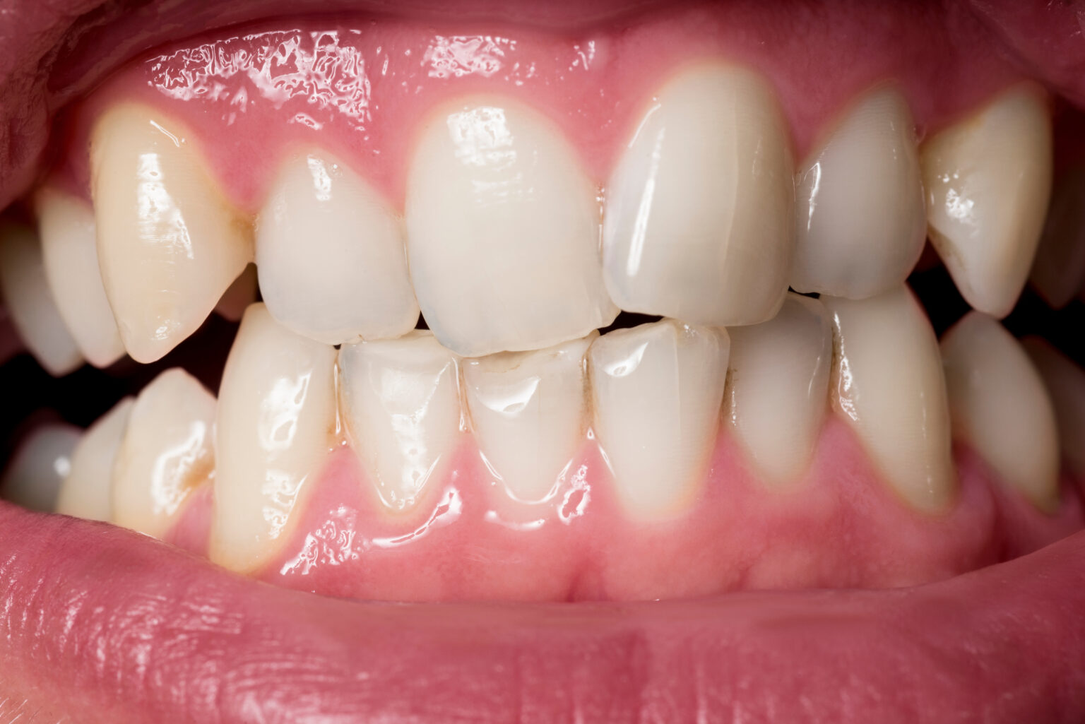 My Gum Line Is Uneven...What Can I Do?
