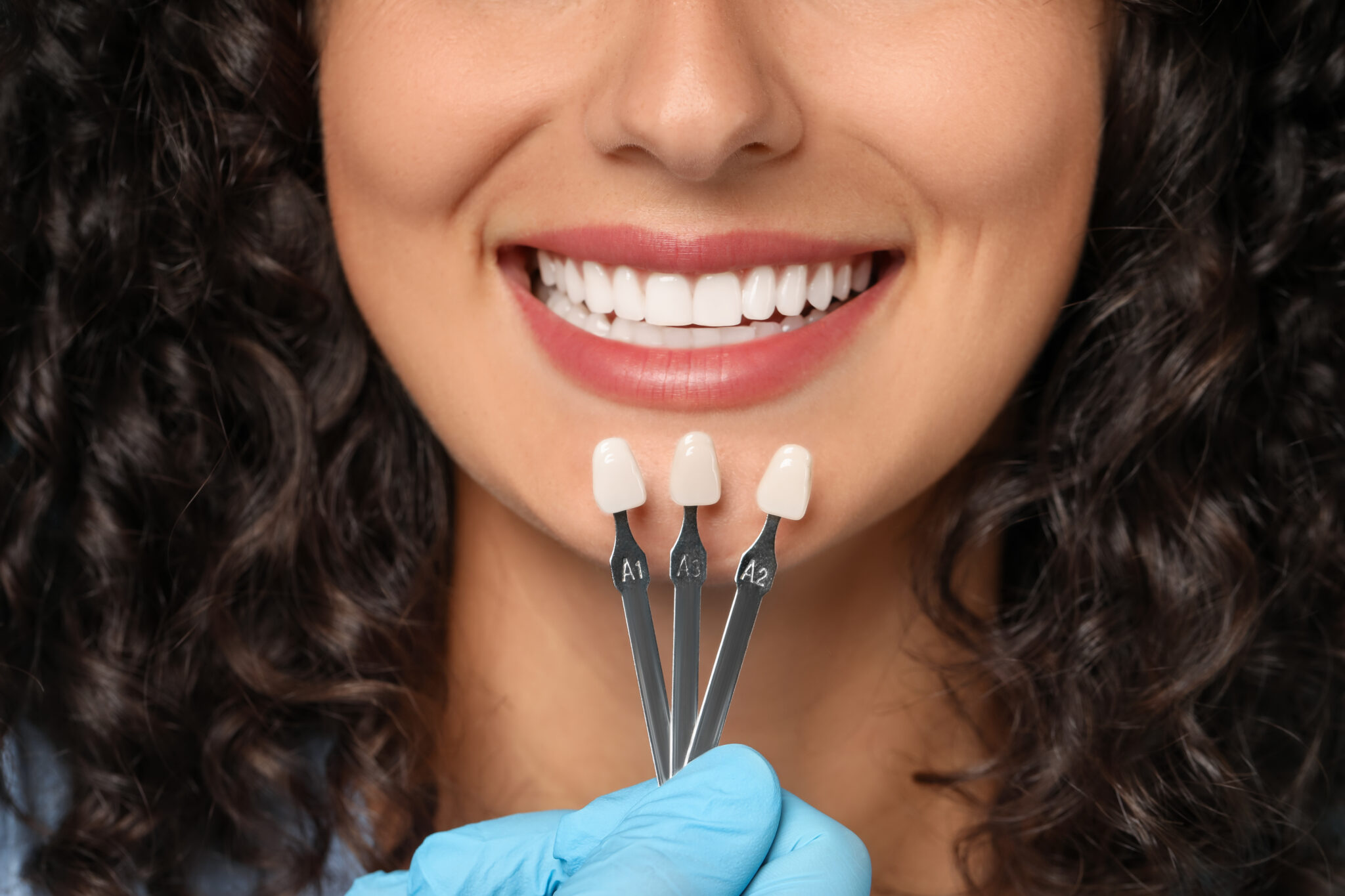 4 Alternatives to Dental Crowns & How to Choose the Right Option